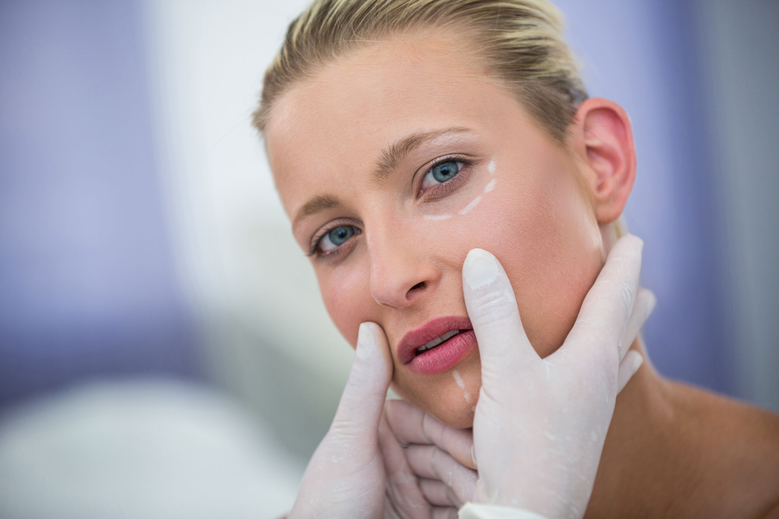 Thread Lift Procedure: The Non-Surgical Facelift - Aura Aesthetics